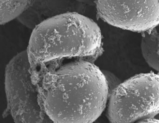 Sudden deaths from micro-clots | Mask Covid Info